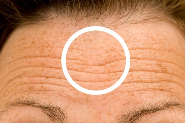 BUNNY NOSE WRINKLES - Beautify